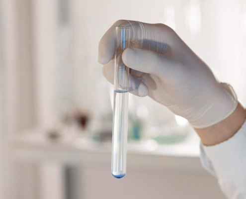 Test Genético y consulta de medicina Antiaging - Instituto Médico ...